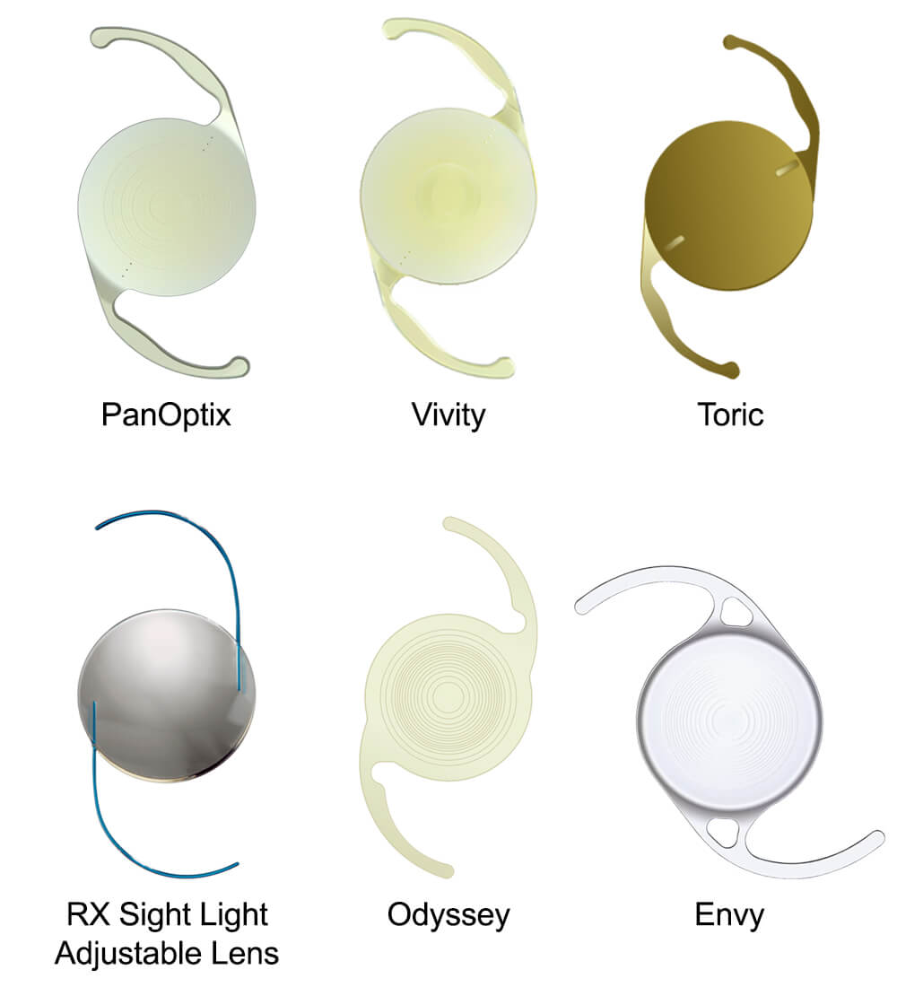 Cataracts Fort Worth | Intraocular Lens Fort Worth | Texas Eye